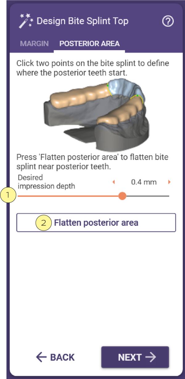 Design the bitesplint top - exocad