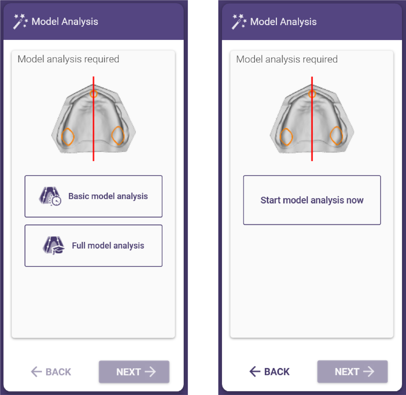 Model analysis - exocad