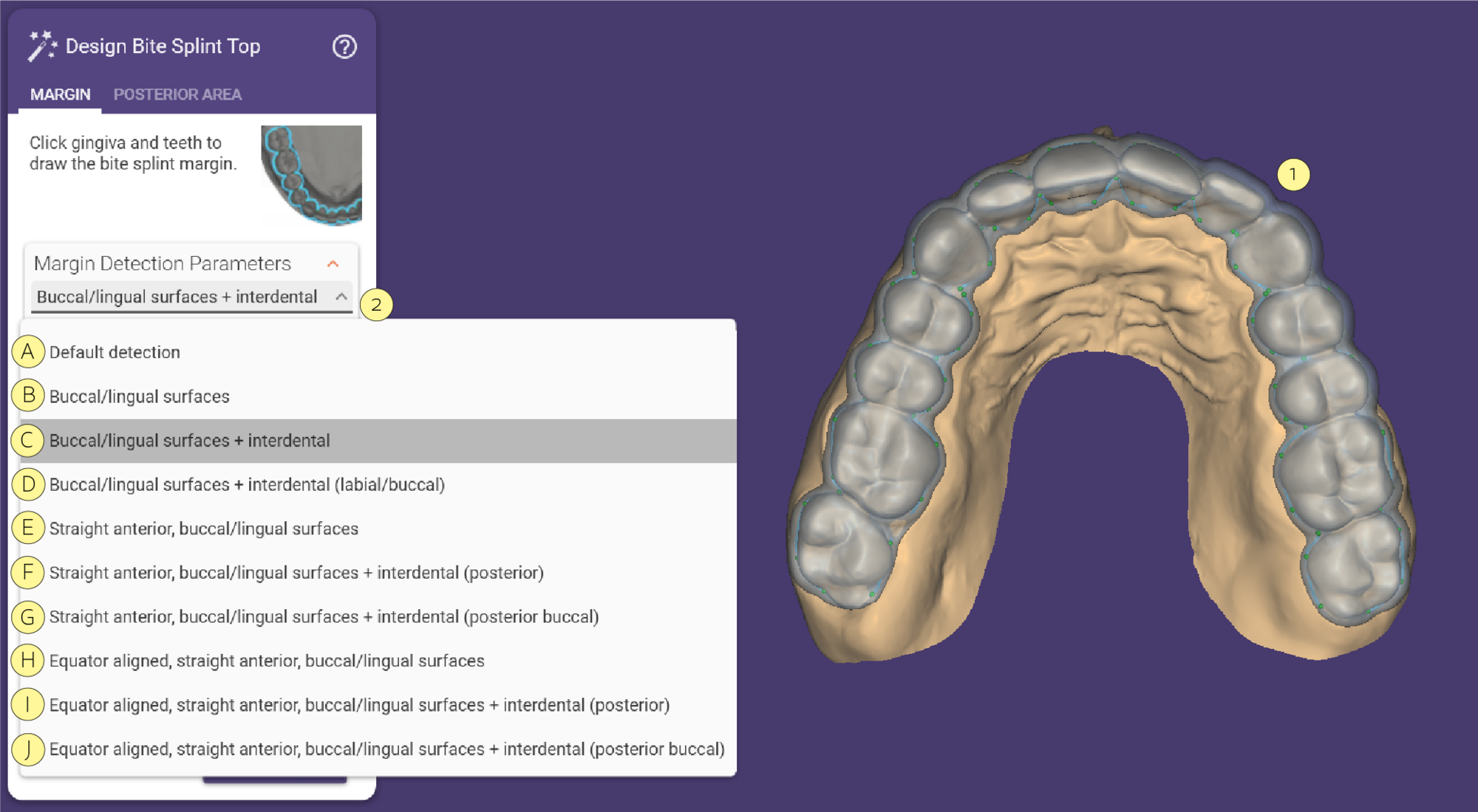 Design the bitesplint top - exocad