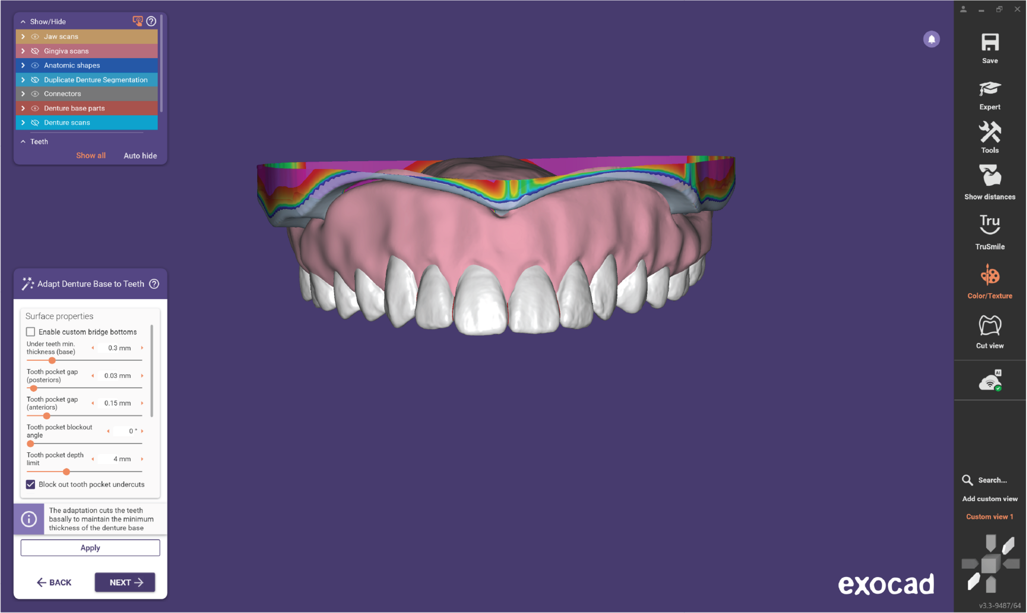 Duplicate denture - exocad