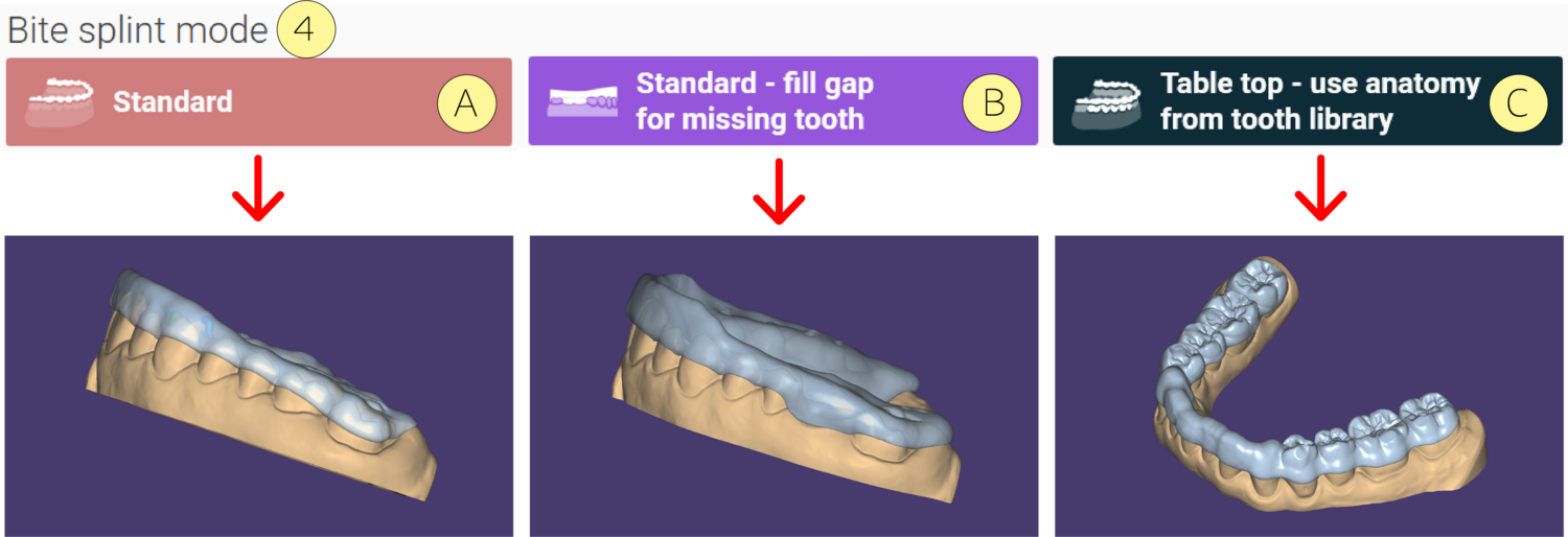Bite Splint - exocad