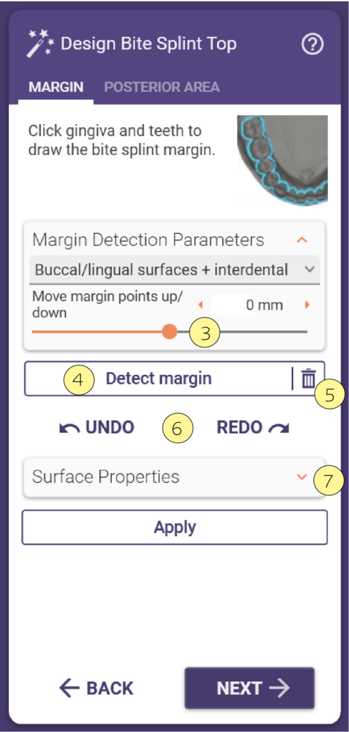 Design the bitesplint top - exocad
