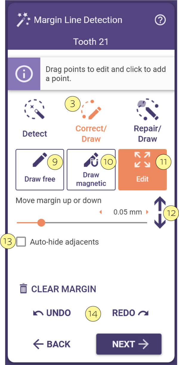 Detect / edit margins - exocad