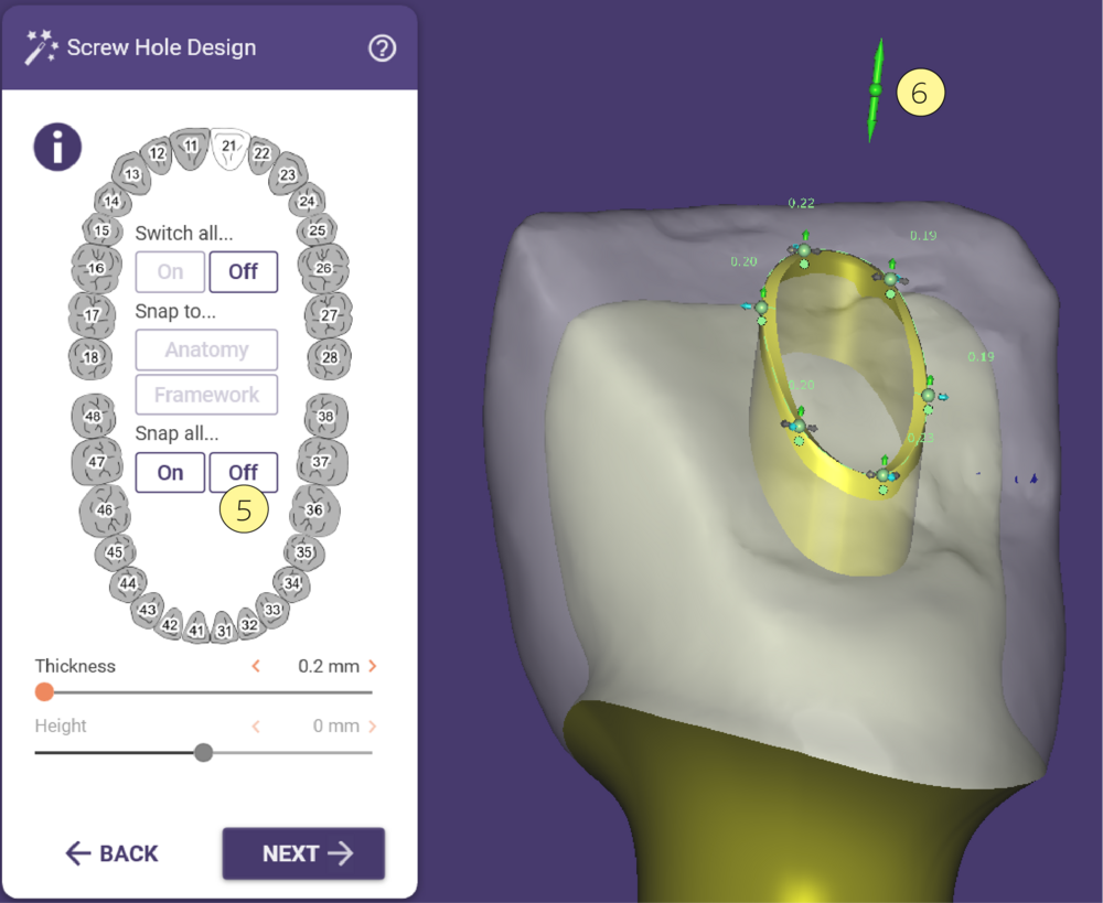 Screw hole design - exocad