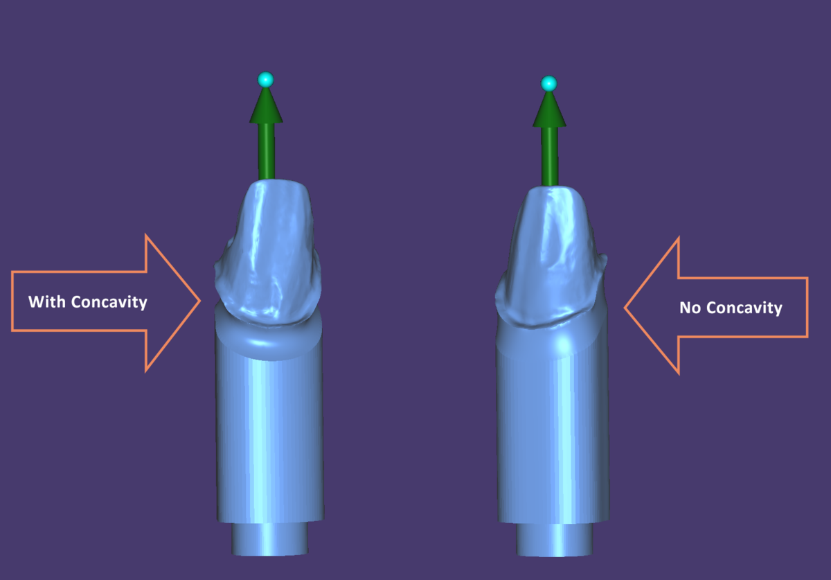 Model Design - exocad