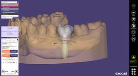 Dental-CAD-Plattform-Dokumentation - Übersicht der Themen – exocad