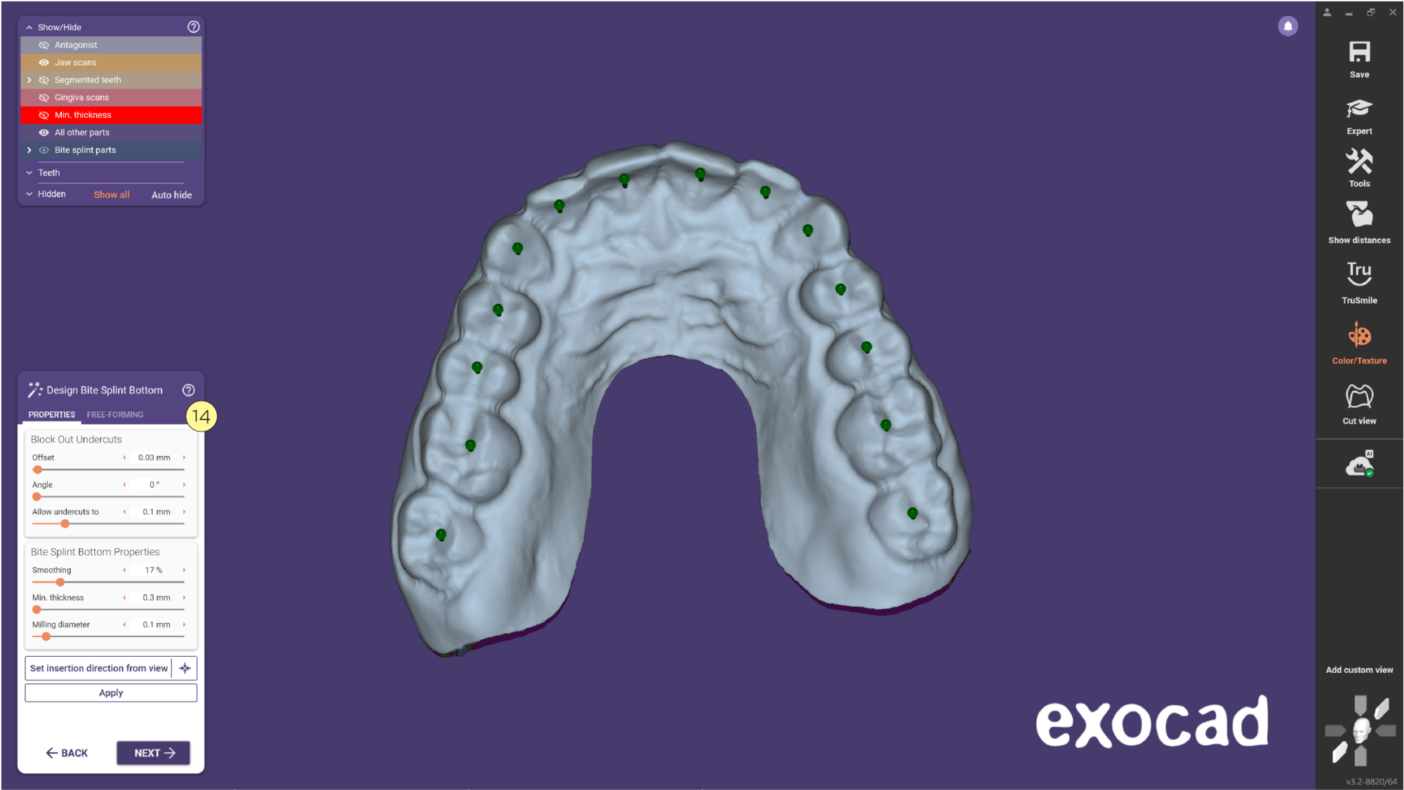 Bite Splint - exocad
